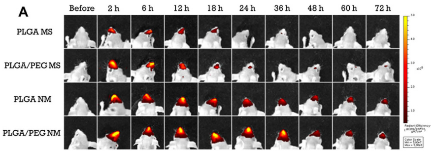 Sinonasal Delivery of Resveratrol via Mucoadhesive Nanostructured ...